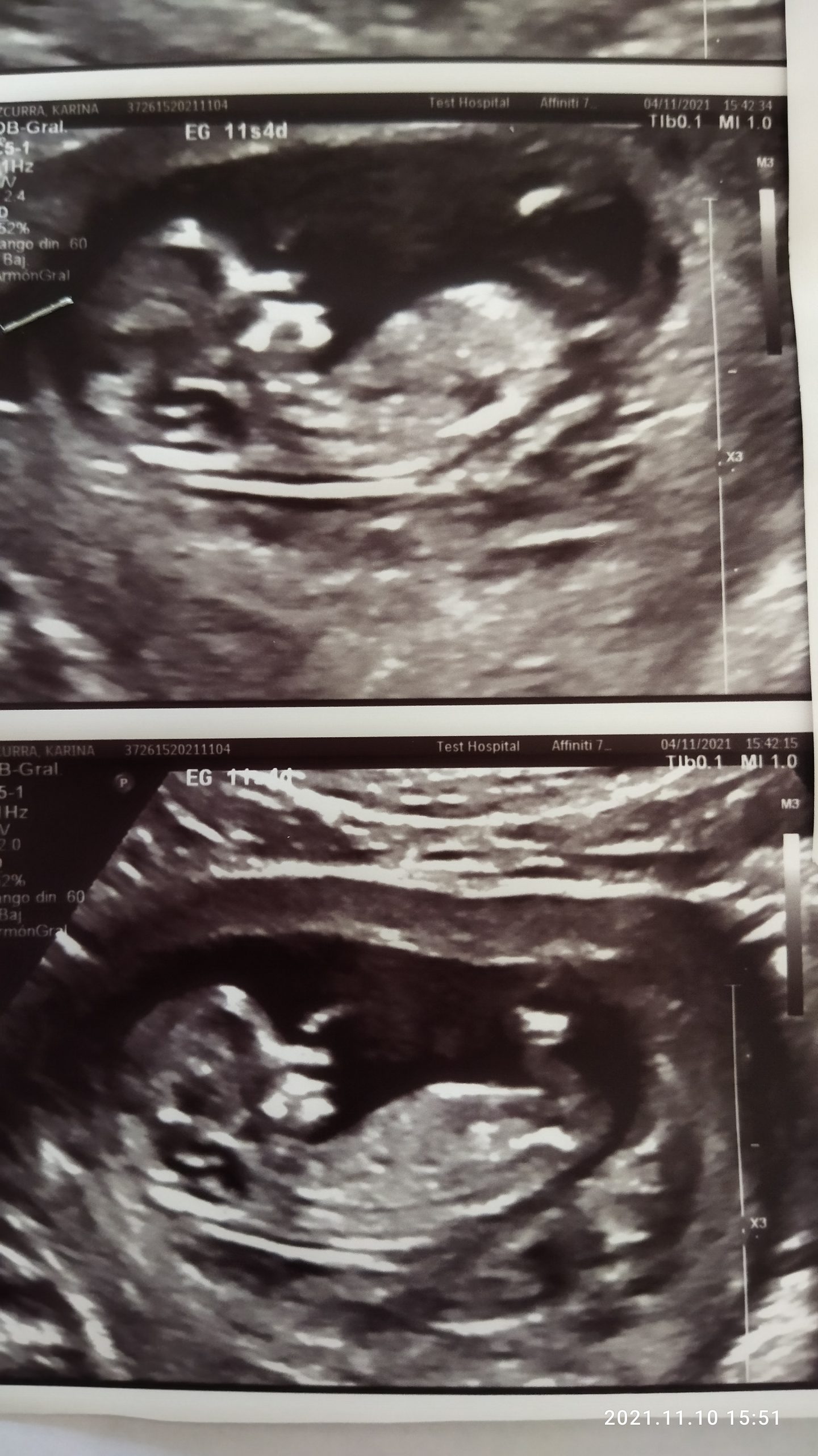 El comienzo de un sueño hecho realidad - Halitus Instituto Médico ...